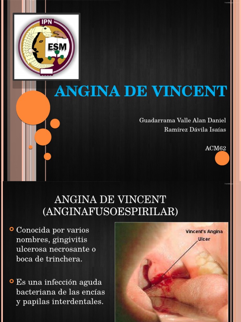 Angina de Vincent: Causas y Tratamiento | PDF | Enfermedades y ...