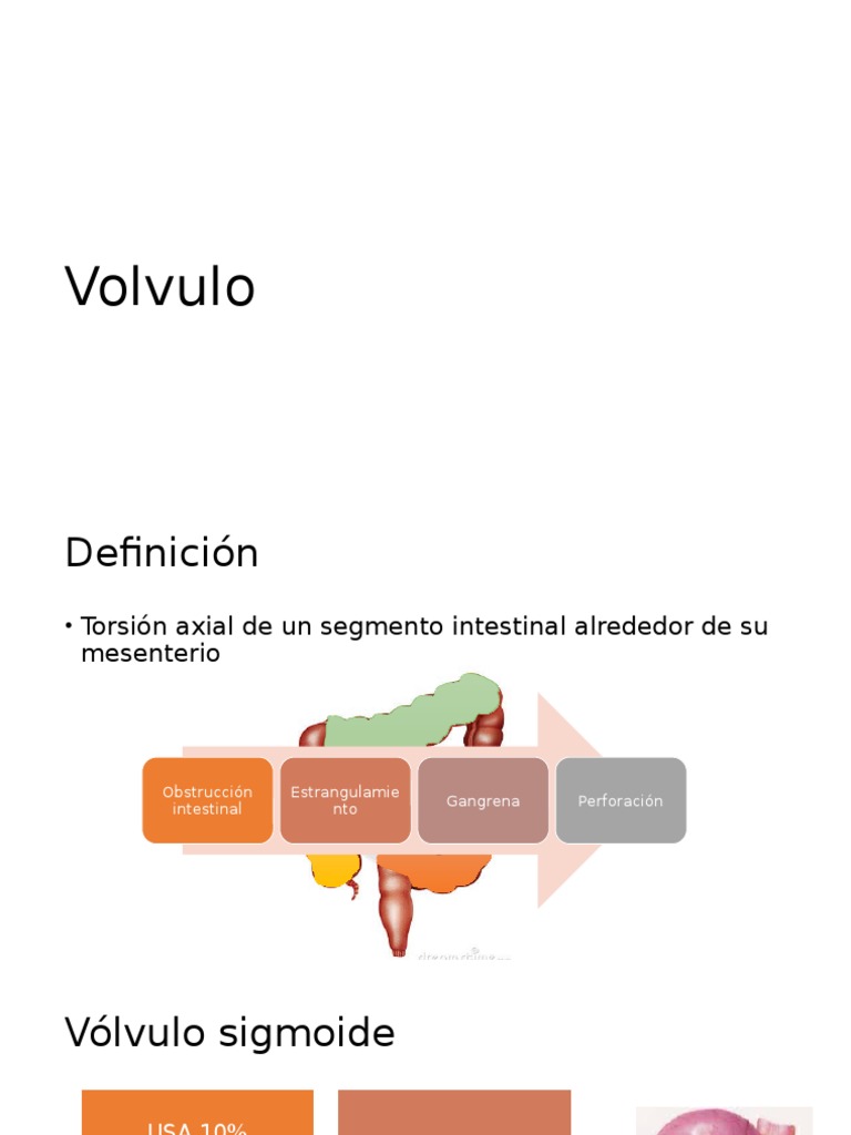 Volvulo | PDF
