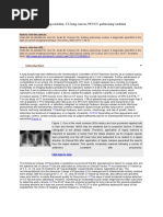2017 Fleischner Guidelines for Nodules | PDF | Ct Scan | Cancer