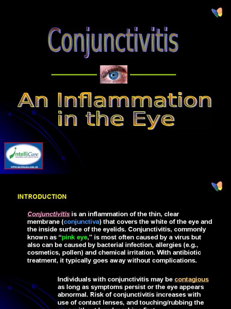 Overview of Conjunctivitis Causes and Treatment | PDF | Medical Specialties | Diseases And Disorders