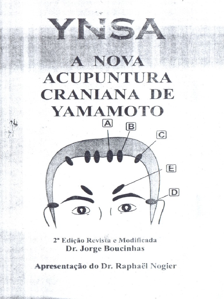 YNSA - A Nova Acupuntura Craniana de Yamamoto PDF | PDF | Acupuntura ...