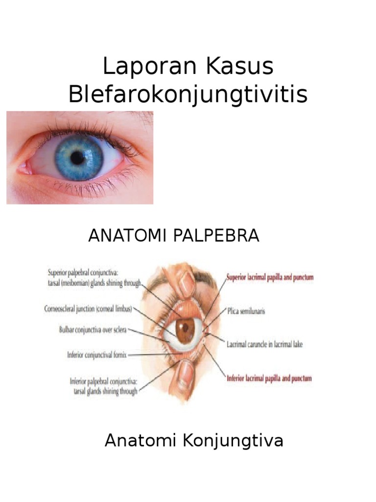 Laporan Kasus Blefarokonjungtivitis