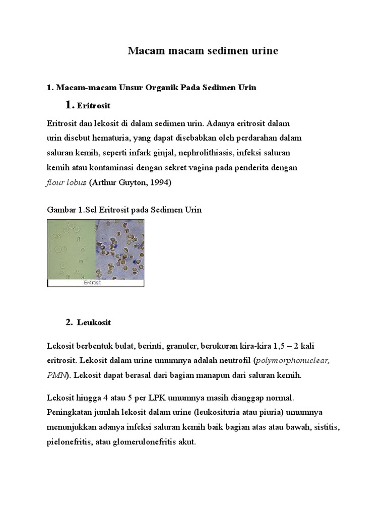 Jenis-Jenis Sedimen Urin dan Maknanya | PDF | Griya & Taman | Kesehatan ...