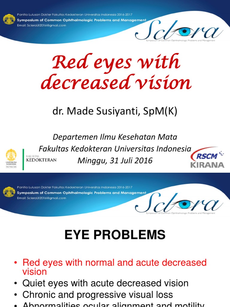 Mata Merah Visus Turun | PDF | Cornea | Human Eye