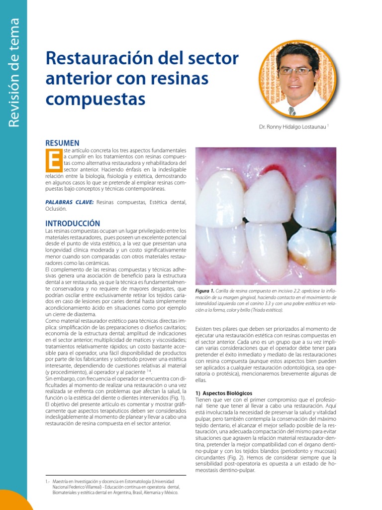 Restauración Anterior con Resinas | PDF | Aluminio | Diente