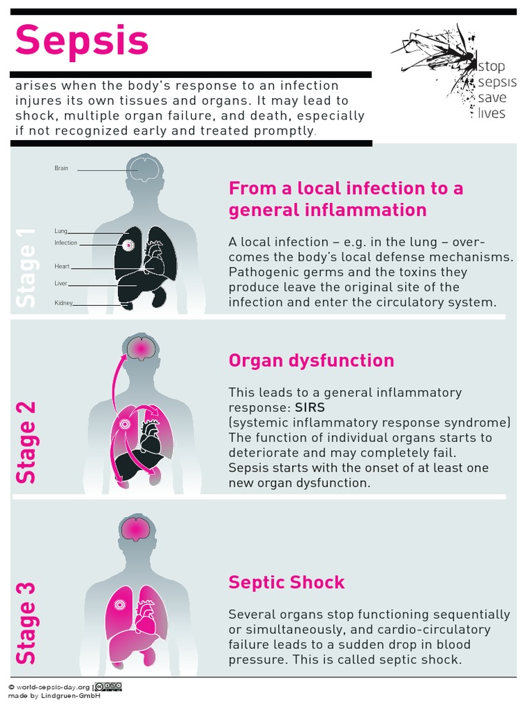 02 What Is Sepsis | PDF