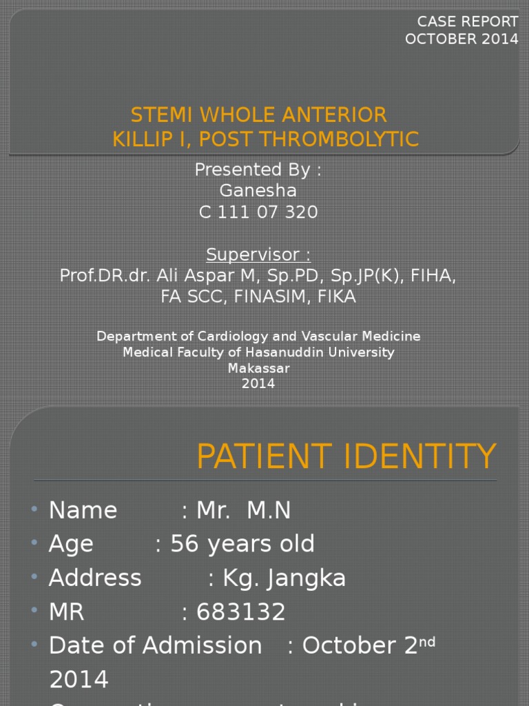 STEMI Whole Anterior Killip I, Post Thrombolytic: A Case Report on a 56 ...