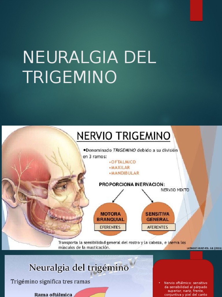 Neuralgia Del Trig mino Causas Y Tratamiento PDF Neurolog a Medicina