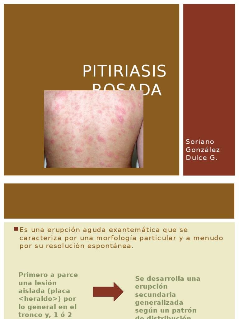 Pitiriasis Rosada | PDF | Pie | Piel