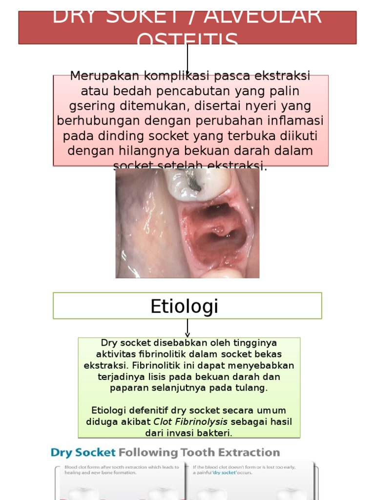 Modul 2 DRY SOKET | PDF