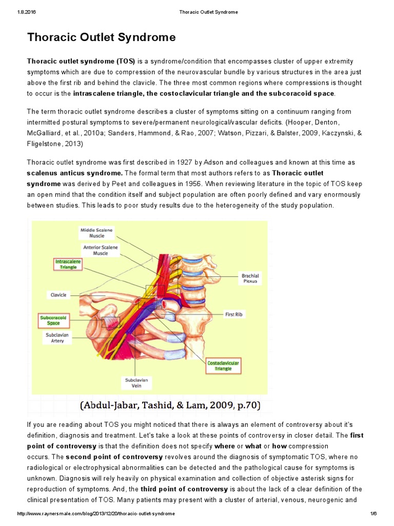 Thoracic Outlet Syndrome - Rayner & Smale | PDF | Human Anatomy ...