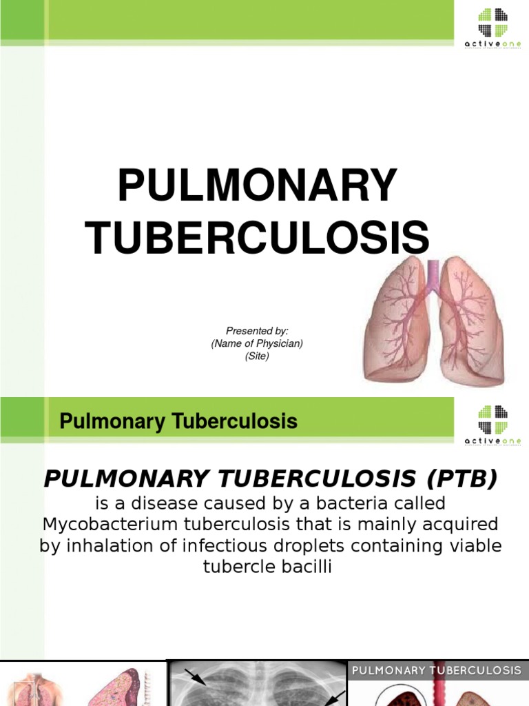 Pulmonary Tuberculosis 2016.pptx | Tuberculosis | Infection
