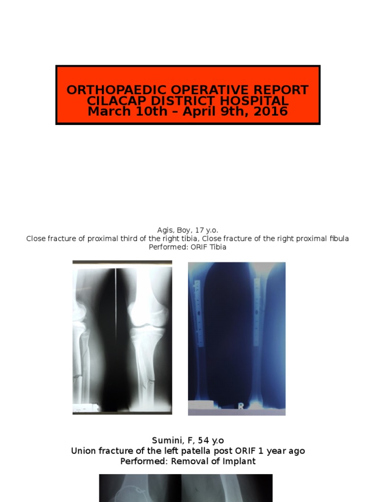 Orthopaedic Operative Report Cilacap District Hospital March 10th ...