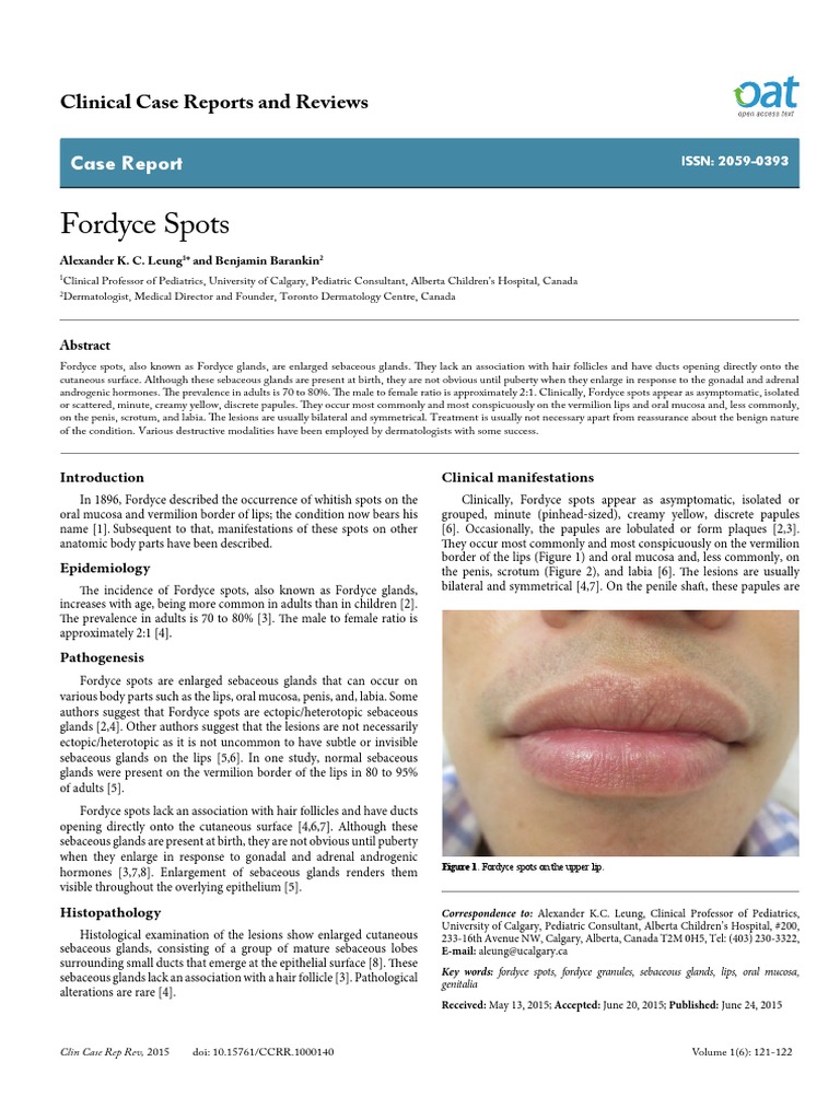 Fordyce Granules Lip