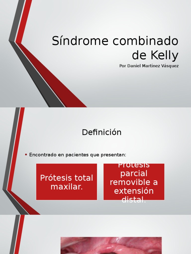 Síndrome Combinado de Kelly | PDF