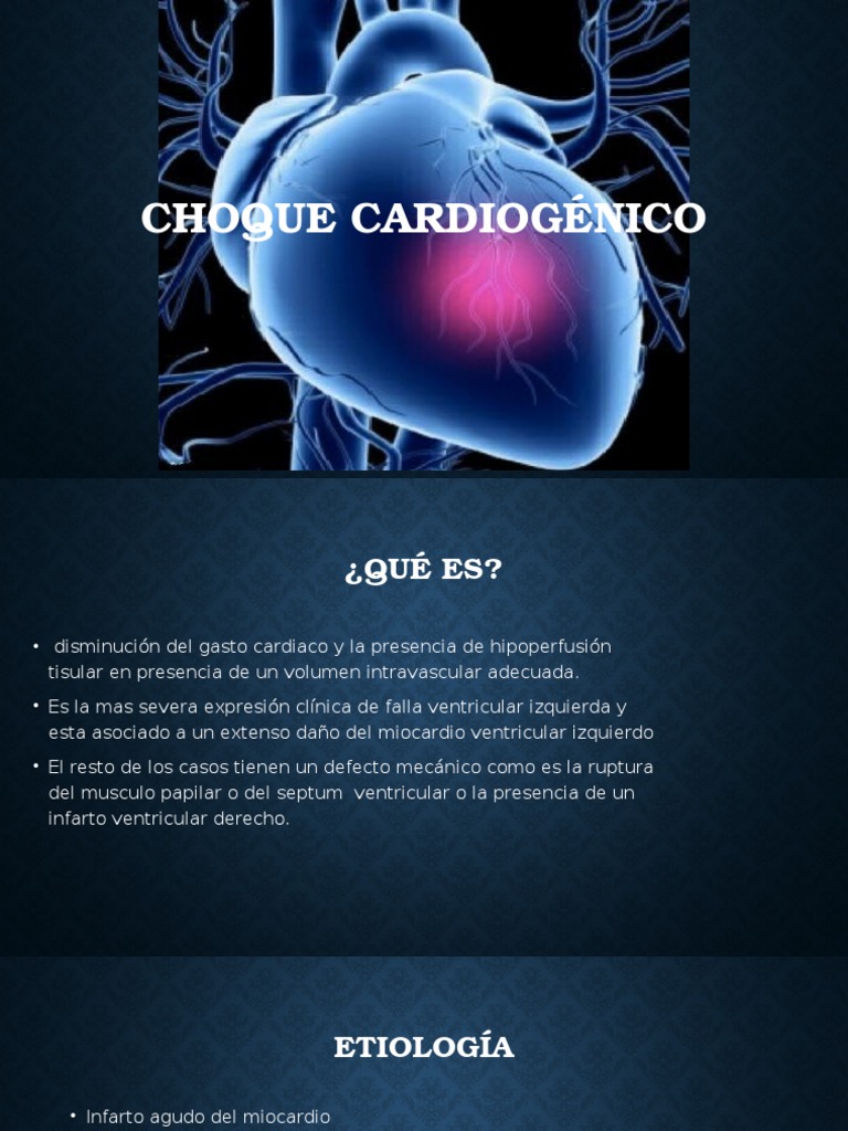 Choque Cardiogenico | Infarto agudo de miocardio | Músculo cardíaco