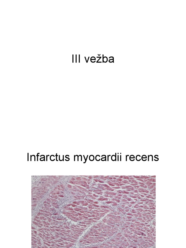 Preparati Za Prakticni Iz Patologije, III, Infarctus Myocardii Recens | PDF