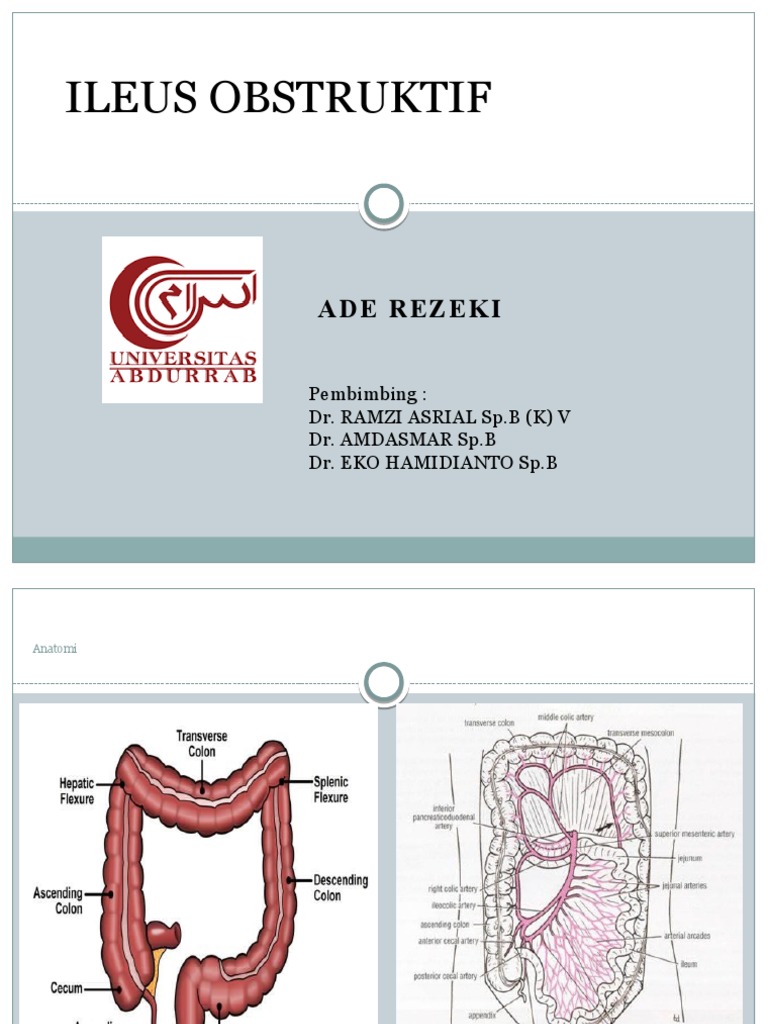 Ileus Obstruktif | PDF