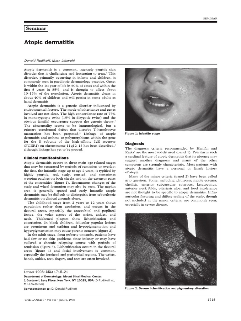 Atopic Dermatitis 2 Pdf Pdf T Helper Cell Interleukin