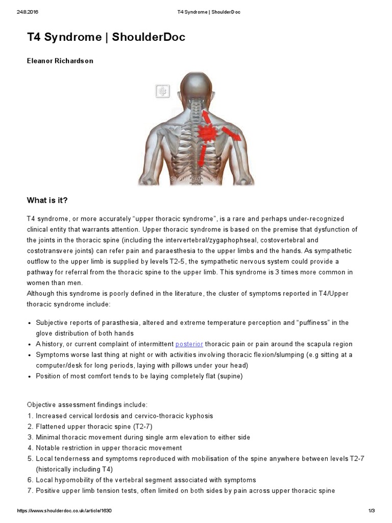 T4 Syndrome: Symptoms & Treatment | PDF | Physical Therapy | Vertebral ...