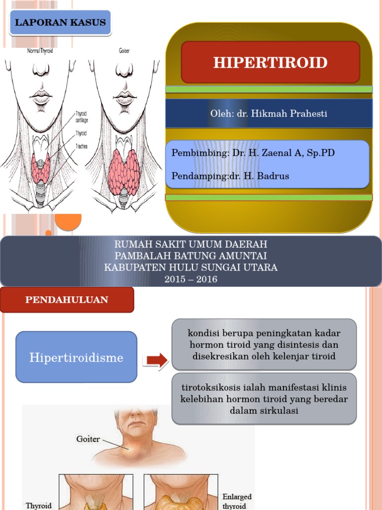Laporan Kasus Hipertiroid | PDF