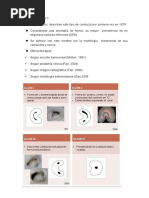 Técnicas Ápico-Coronales en Endodoncia | PDF | Ramas de Odontología