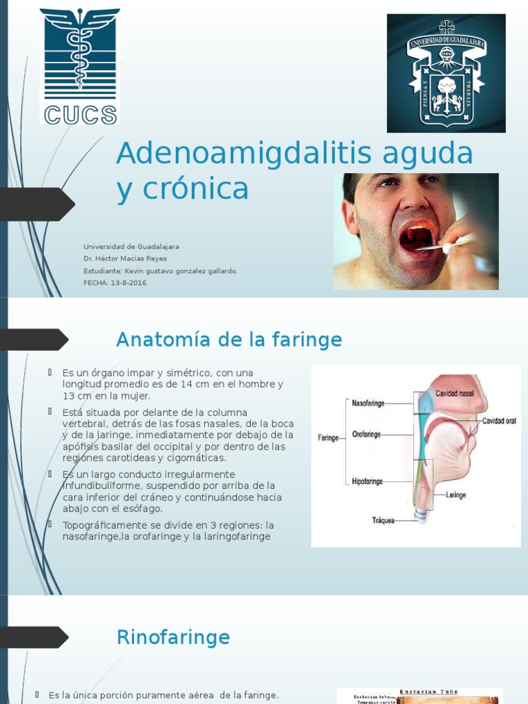 Adenoamigdalitis Aguda y Crónica | PDF | Lengua | Estreptococo