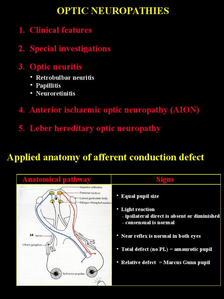 Optic Neuropathies: 1. Clinical Features 2. Special Investigations 3 ...