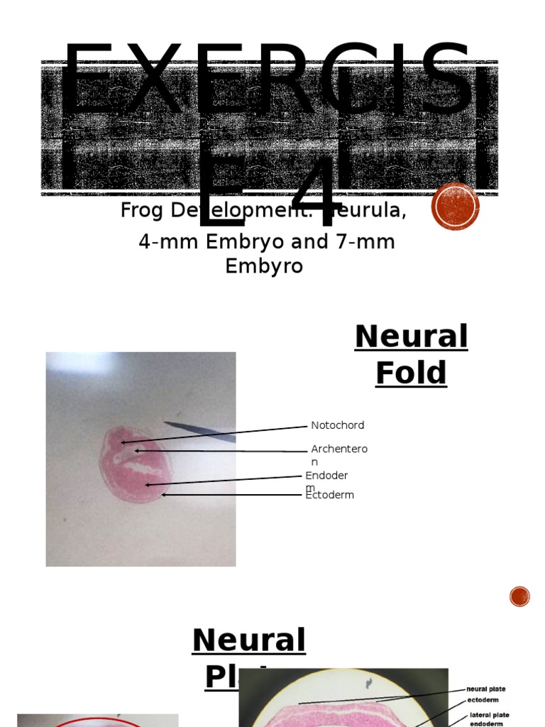 Exercis E4: Frog Development: Neurula, 4-mm Embryo and 7-mm Embyro ...