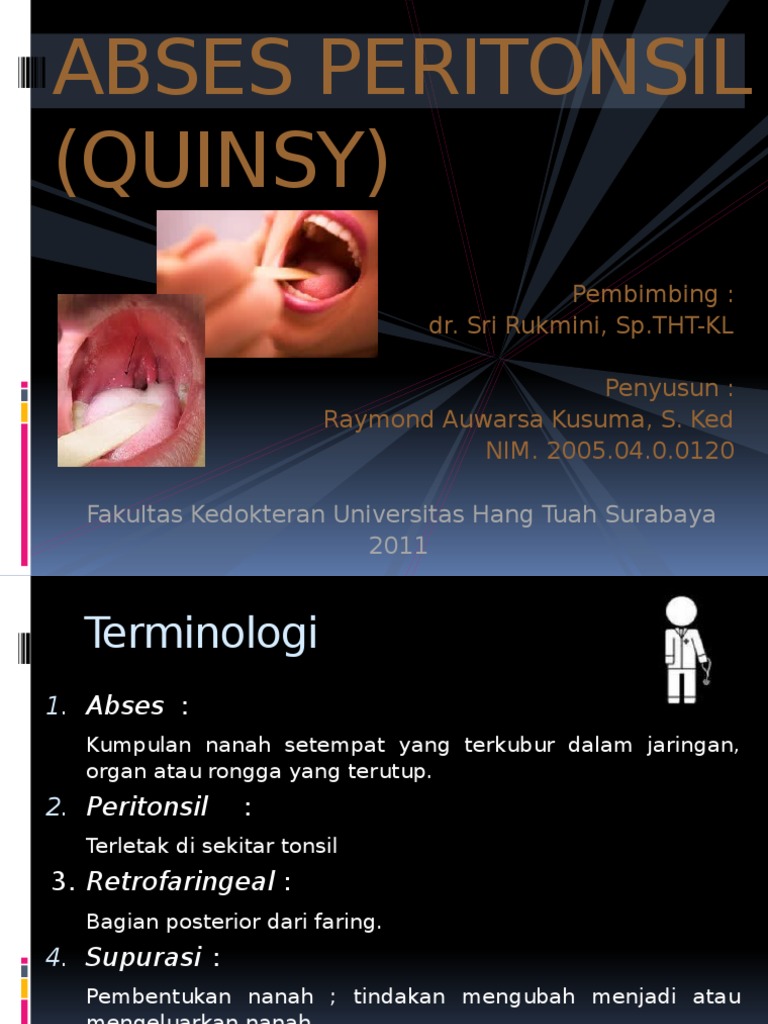 Abses Peritonsil Retrofaring | PDF