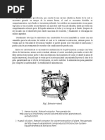 Extractor de Bollman