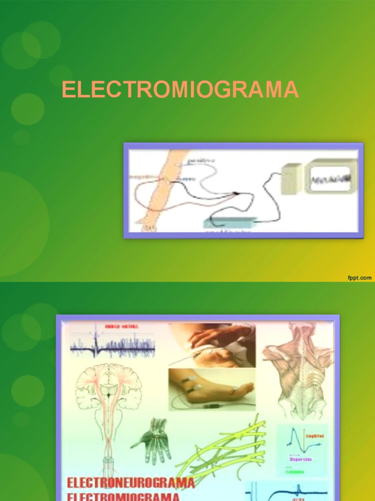 Clase 3 Electromiograma | PDF | Electromiografia | Neurología