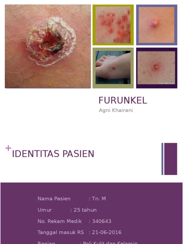 FURUNKEL | PDF