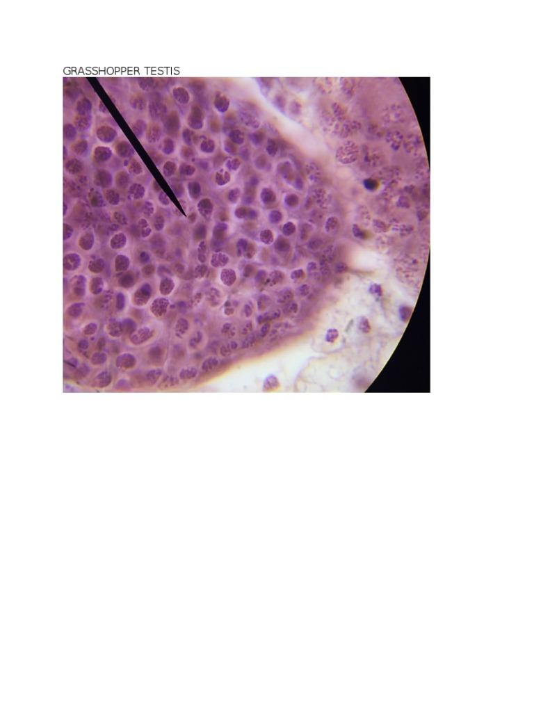 Grasshopper Testis | PDF
