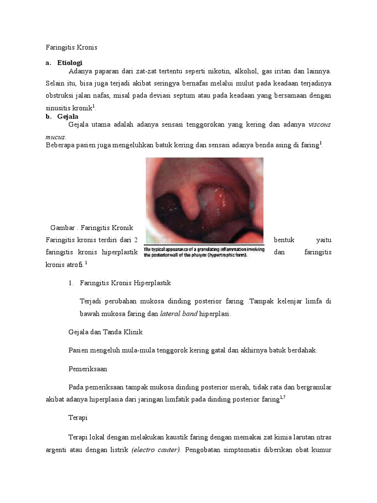 Faringitis Kronis | PDF