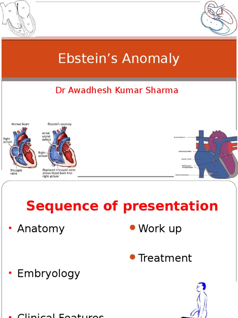 Eb Stein | PDF | Heart Valve | Heart Failure