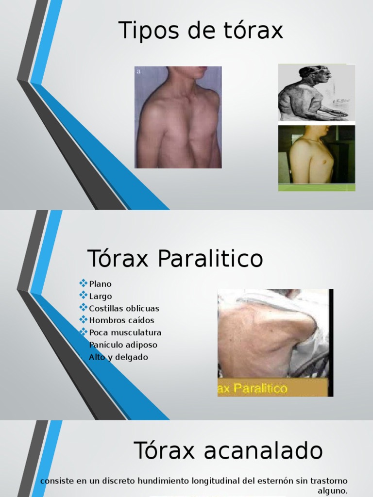 Tipos de Tórax y sus Características | PDF