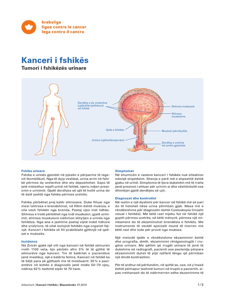 Tumoret e Fshikez Urinare (1)