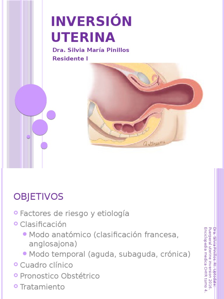 Inversión Uterina | PDF | Parto | Rtt