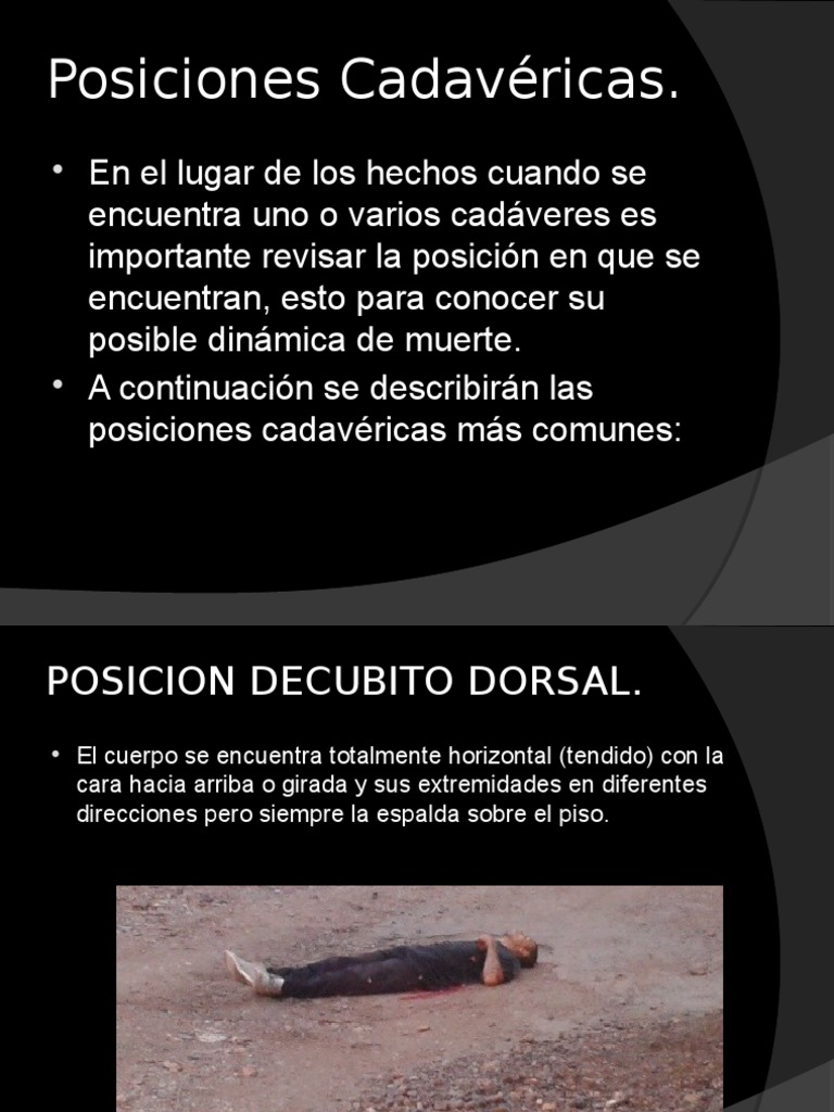 Posiciones Cadavéricas | PDF
