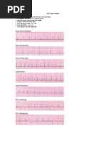 034 NHA NOW EKG Technician Practice Test | PDF | Electrocardiography ...