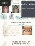 Tipos de Líneas de Terminación Dental | PDF | Dentadura postiza | Diente