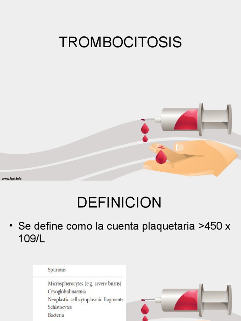 trombocitosis.ppt | Medicina CLINICA | Medicina