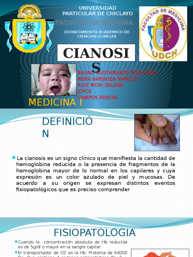 CIANOSIS | PDF | Hemoglobina | Especialidades Medicas