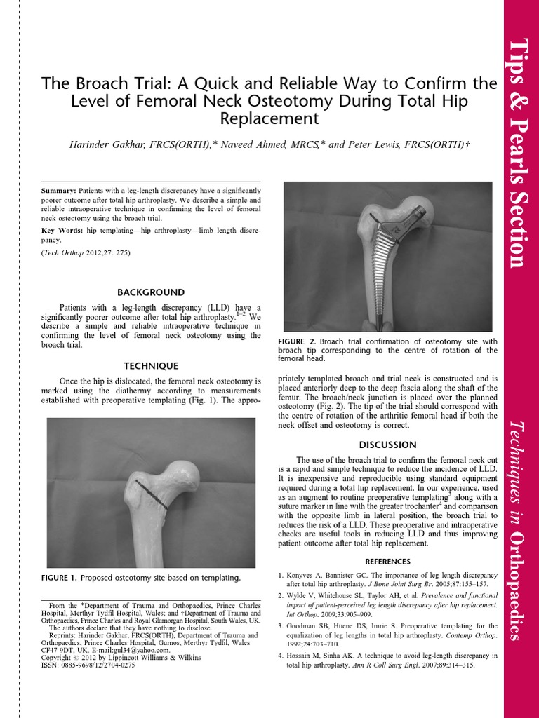 Broach Trial | Hip | Surgical Specialties