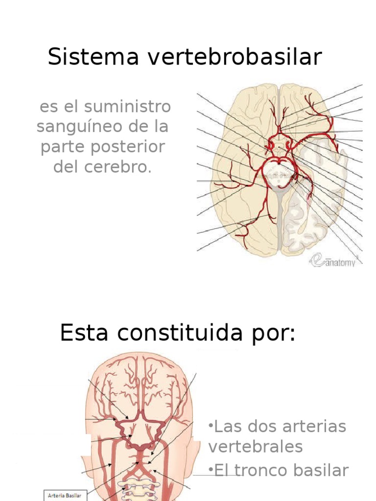 Sistema Vertebrobasilar | PDF