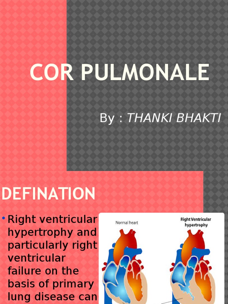 Cor Pulmonale 1 | PDF