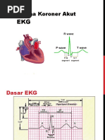 Gambaran EKG Normal Dan Stemi | PDF