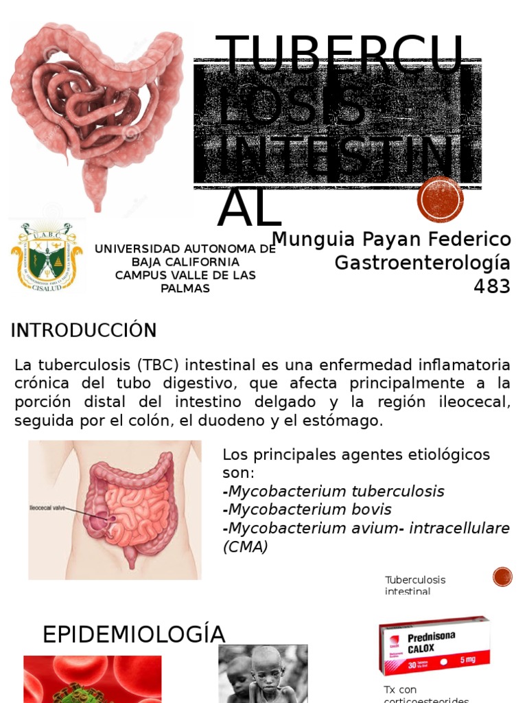 Tuberculosis Intestinal | PDF | Enfermedad de Crohn | Tuberculosis