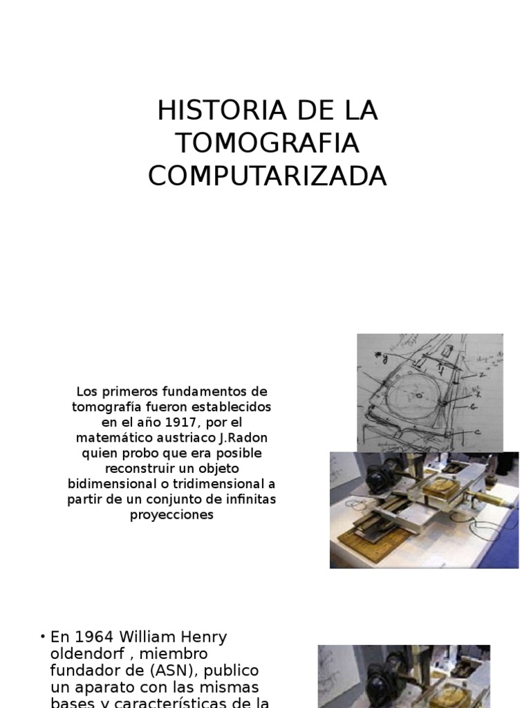 Historia de la Tomografía Computarizada | PDF | Libros para adolescentes